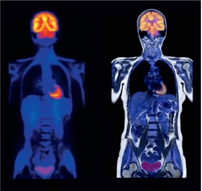 PET Imaging - Macmillan Group